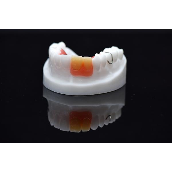 Quality Acrylic Flipper Removable Overdenture Customized Removable Acrylic Denture for sale