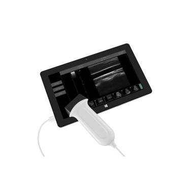 Quality USB Ultrasound Probe Digital Portable Ultrasound Scanner With Probe of Frequency for sale