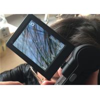 Quality Hair And Skin Checker Video Dermatoscope Observing Skin And Hair With 230 Times Magnification Stored Picures in SD Card for sale