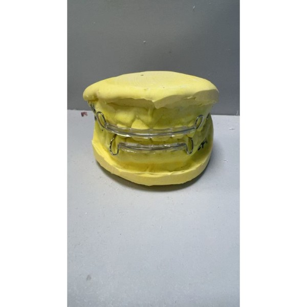 Quality Custom Molded Hawley Retainer with Adjustable Wire for Long-lasting Teeth for sale