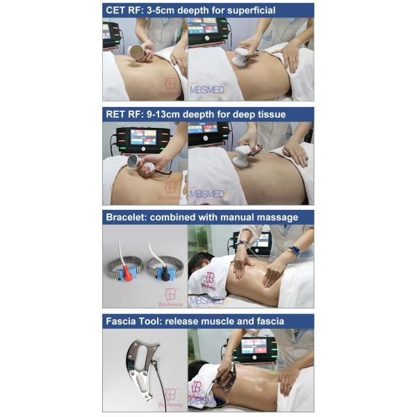 Quality Radiofrequency High Power Rehabilitation Therapy Rf Deep Fascia 448k Tecar for sale