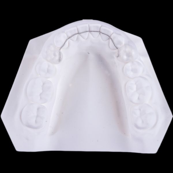 Quality Non Removable Lingual Wire Retainer Orthodontics Retainers To Straighten Teeth for sale