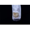 china Dental Crown Composite Inlays And Onlays Restoration Customized Shape