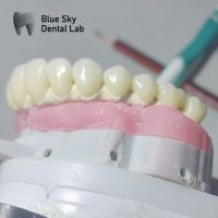 Quality Pure Titanium Malo Implant Bridge Universal Metal Frame Malo Bridge for sale