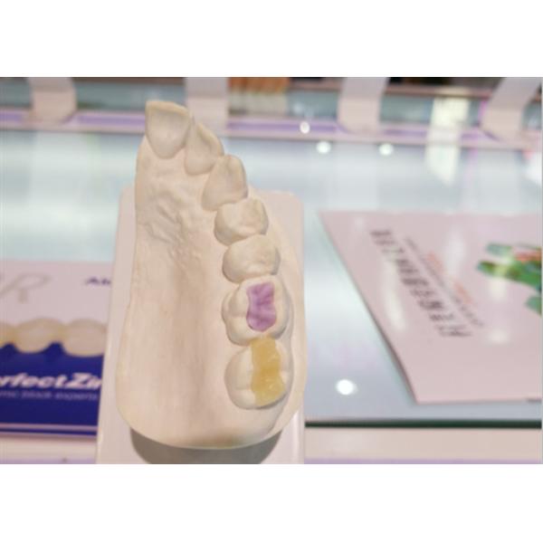 Quality Custom High-Density Custom Dental Ceramics FDA All-Ceramic Crown for sale