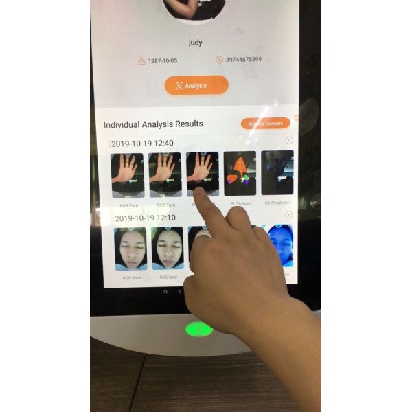 Quality Korea Facial Analysis System Digital 64gb Storage For Doctor Clinic for sale