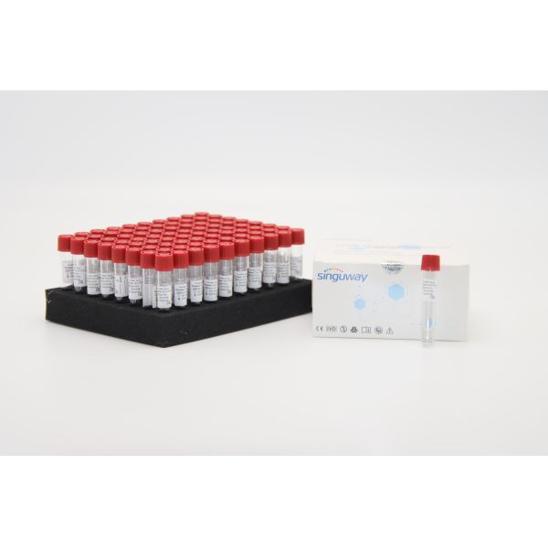 Quality Convenience RNA Extraction Sample Release Reagent Complete Test 80 Tubes / Box for sale