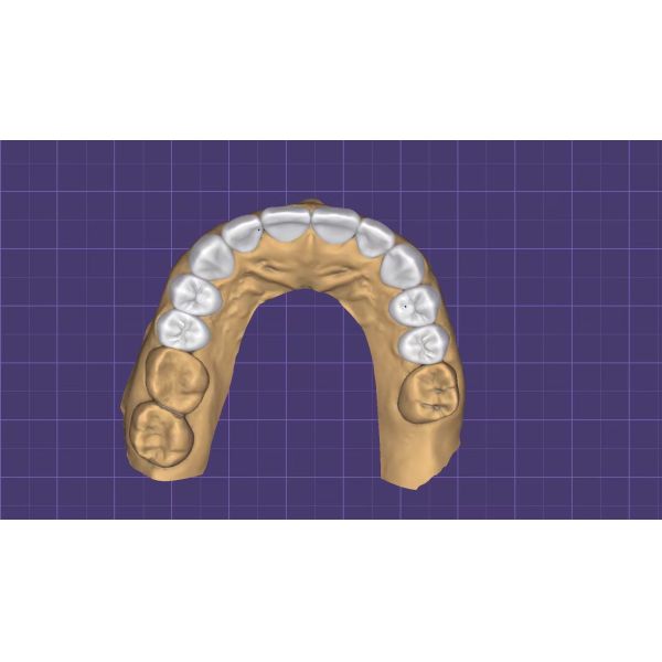 Quality Precision Fit Digital Wax Up Dental Study Model with Durable and Biocompatible for sale