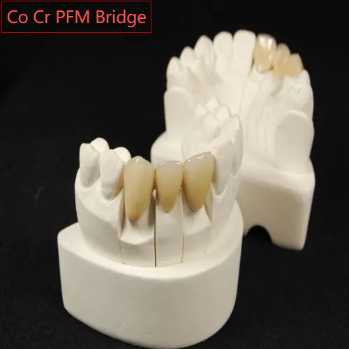 Quality Porcelain Dental Crown Tooth-Shaped Cap for Restoring Shape and Enhancing for sale