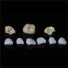 Quality Tooth All Porcelain IPS Emax Inlay Onlay Veneer Aesthetic In Dentistry for sale