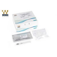 Quality One Step POC Test Kit 500 Tests/Hour FIA Assay For Cardiac Detection for sale