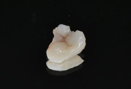 Quality Composite Resin Restoration for Dental Restorations for sale