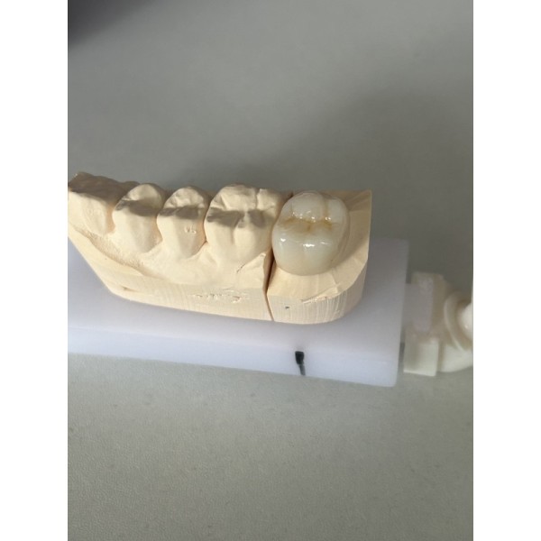 Quality High Strength 1200 MPa Zirconia Crown with Excellent Biocompatibility and Long-lasting Durability for Dental Restoration for sale