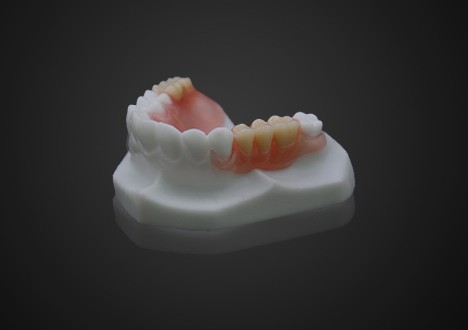 Valplast denture