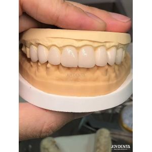 Quality Customized Shades To Match Natural Teeth Biocompatible And Stain Resistant for sale