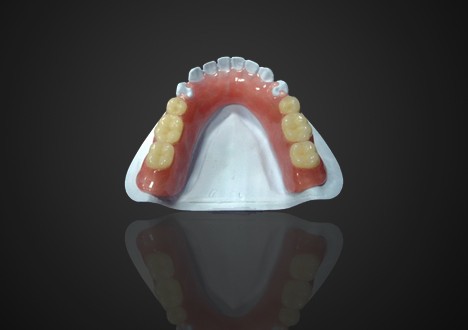 Valplast denture