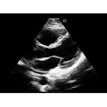 Quality Medical Handheld Ultrasound Doppler Scan Machine With Cardiac Transducer for sale