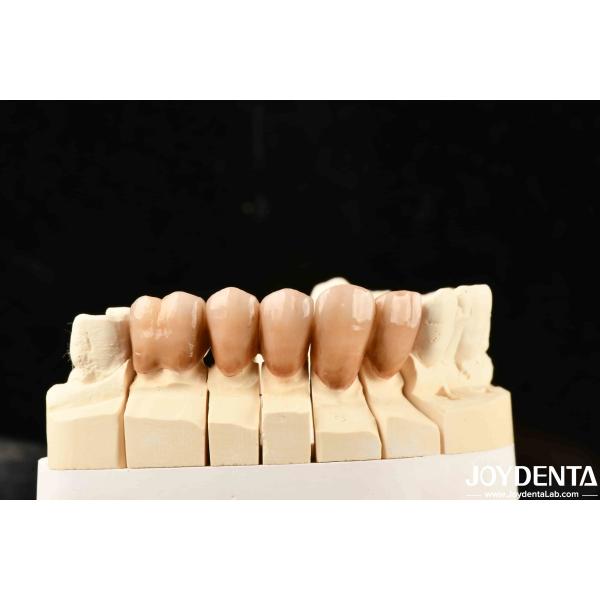 Quality Bionic Teeth Layered Zirconia with Bionic Leaf Micro-Engraving and Multi-color for sale