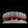 Quality ODM Full Arch Zirconia Implants Bridge Zirconium Implants Holistic Dentistry for sale