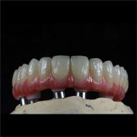 Quality ODM Full Arch Zirconia Implants Bridge Zirconium Implants Holistic Dentistry for sale