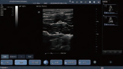 Mobile Phone Probe Wireless Ultrasound Probe Convex Linear Transvaginal Micro-convex Changeable Probe