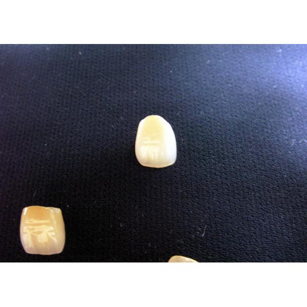Quality Strong Cosmetic PFM Porcelain Fused Metal Crown Colour Stability for sale