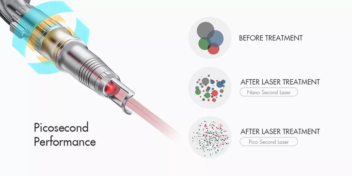 pico laser machine prices