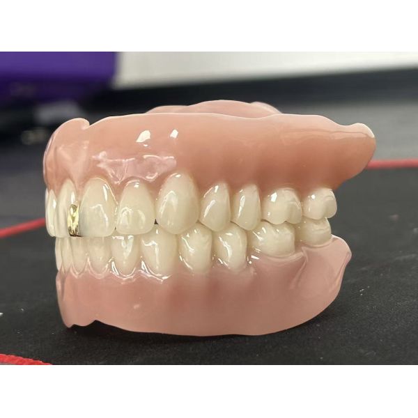 Quality Custom Full Denture with Natural Appearance and Comfortable Fit for Complete for sale
