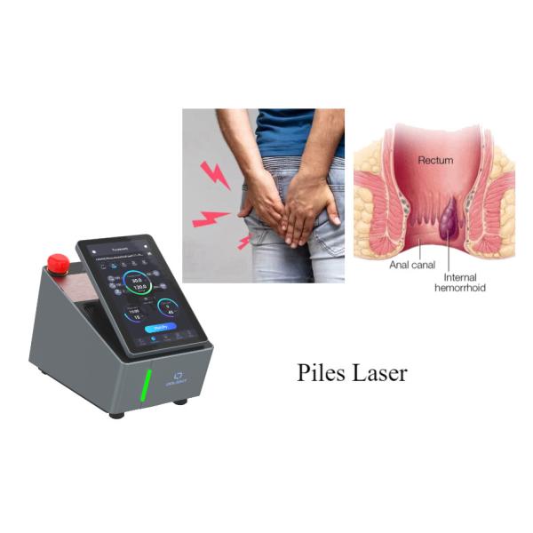 Quality Two Wavelength Diode Laser Machine 980nm 1470nm Hemorrhoid Treatment for sale