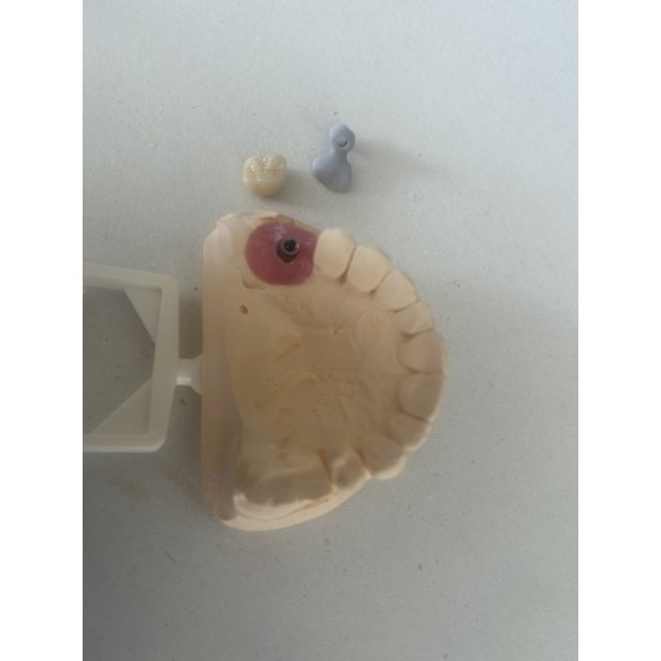 Quality Full Zirconia Cement Retained Abutment for Implant-Supported Dental Restorations for sale