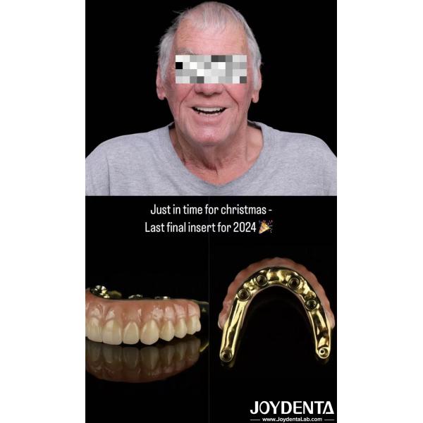 Quality Prosthetic Platform 4.1mm Full Arch Implant with 10-16mm Length Surgical Kit Included for sale