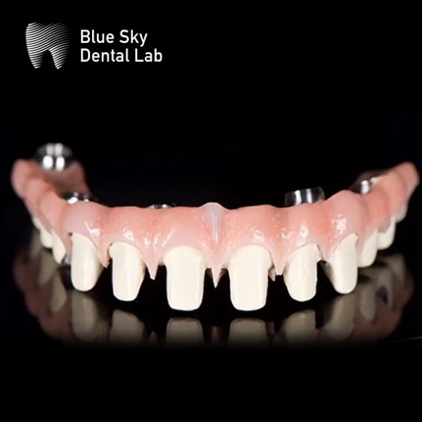 Quality Customizable Pure Titanium Malo Bridge Dental Blue Sky Implant System for sale