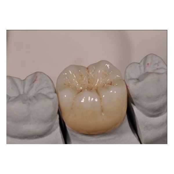 Quality High Aesthetic Noritake Zirconia Natural Color Stable For Full Zirconia Crown for sale