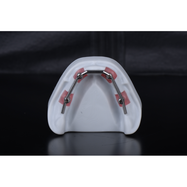 Quality Titanium Implant and Implant Bar for sale