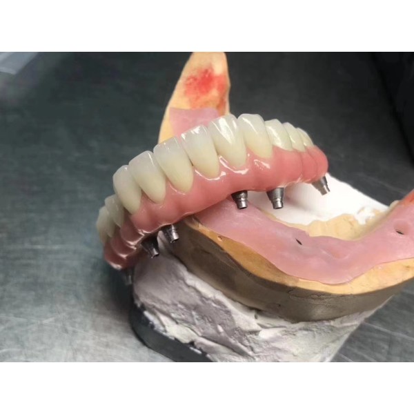 Quality High Translucency Solid Implant Supported Crown Customizable For Dental for sale
