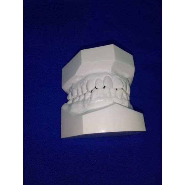 Quality Dental Study Model with CAD CAM Digital Design and 3D Printing Workflow for for sale