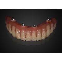 Quality Customized Replacing Dental Implant Crown Wear Resistant For Long Term Use for sale