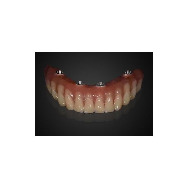 Quality Customized Replacing Dental Implant Crown Wear Resistant For Long Term Use for sale
