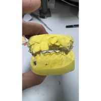 Quality Custom Fit Orthodontic Facemask with Palatal Springs and Adjustable Design for sale