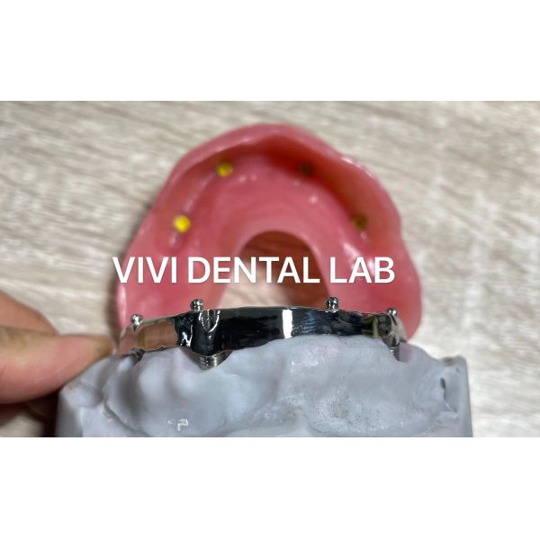 Ivoclar Digital Dental Implant Bar Denture With Attachments from China ...