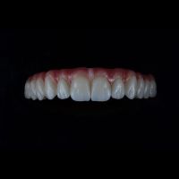 Quality Full Coutour Arch Zirconia Fixed Dentures Crown Biocompatible Material for sale