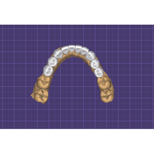 Quality Precision Fit Digital Wax Up Dental Study Model with Durable and Biocompatible for sale