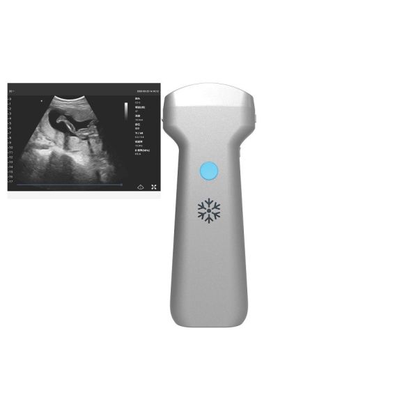 Quality Electronic Convex Array Convex Wireless Ultrasound Probe 2MHz 3.6MHz 5MHz for sale