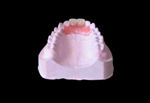 Quality Valplast Partial Denture with Flexible Nylon Material for Secure Comfort and for sale