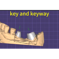 Quality Key and Keyway for Common Path of Insertion with Precision Fit and Durable for sale