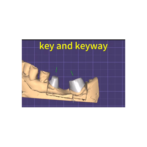 Quality Key and Keyway for Common Path of Insertion with Precision Fit and Durable Construction for sale