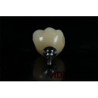 Quality China Dental Lab Ceramic Zirconia Screw Retained Dental Implant Single Tooth for sale