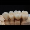 Quality Biocompatible Zirconia Ceramic Dental Crown Tooth Restorations Custom for sale