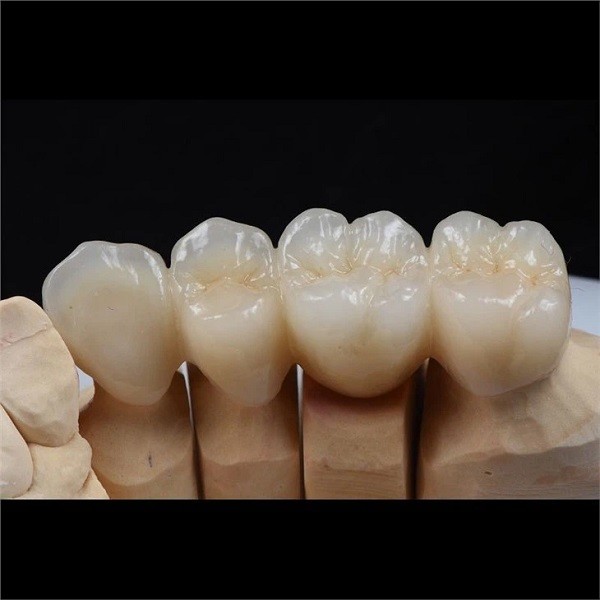 Quality Biocompatible Zirconia Ceramic Dental Crown Tooth Restorations Custom for sale