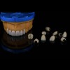china Porcelain Ceramic PFM Dental Crown Material For Restoration